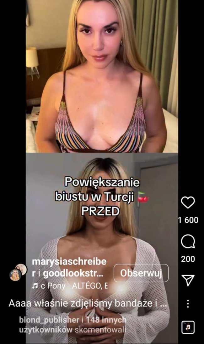 Marianna w wielkim stylu powiększyła swoje "atuty". Wiemy, ile trzeba za to zapłacić [tylko u nas]